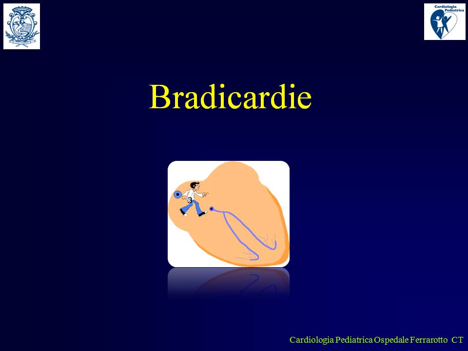 Ecg Aritmie – Cardiologia Pediatrica